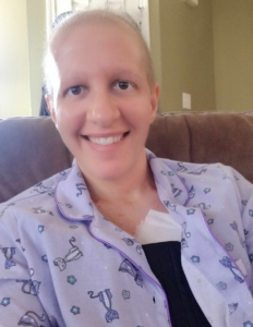 When Hair Loss is About More than Just Hair: Jessica’s Story - National ...