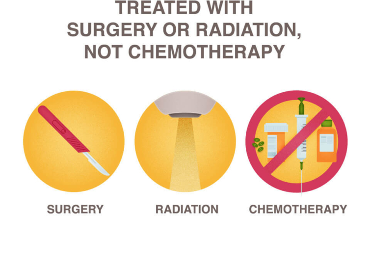 Stage 0 Breast Cancer - Symptoms, Treatment & Survival Rate