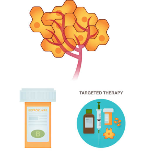 Targeted Therapy - National Breast Cancer Foundation